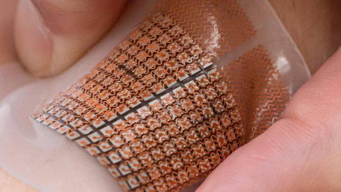 New Patch Uses Ultrasound Array to Monitor Blood Flow