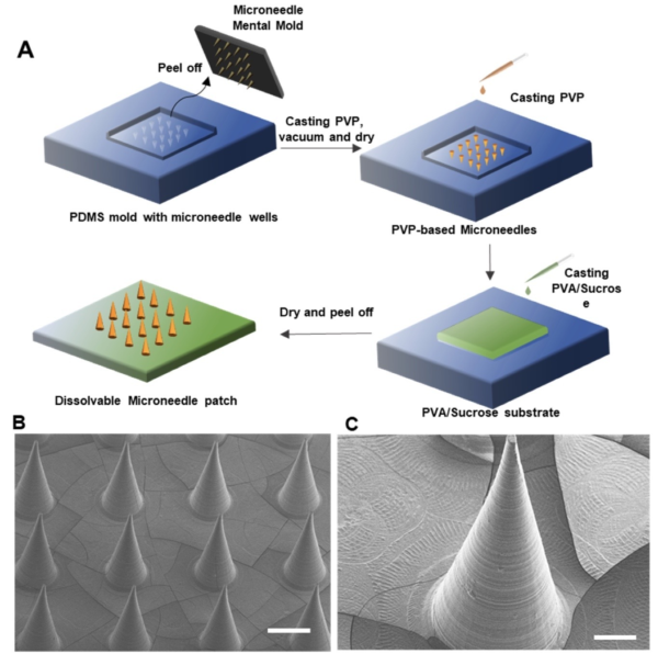 Rapamycin-Loaded Microneedles Reverse Hair Loss in Mice Rapamycin-Loaded Microneedles Reverse Hair Loss in Mice