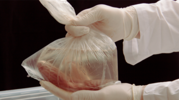 Preserved Kidneys Rewarmed and Transplanted in Rats