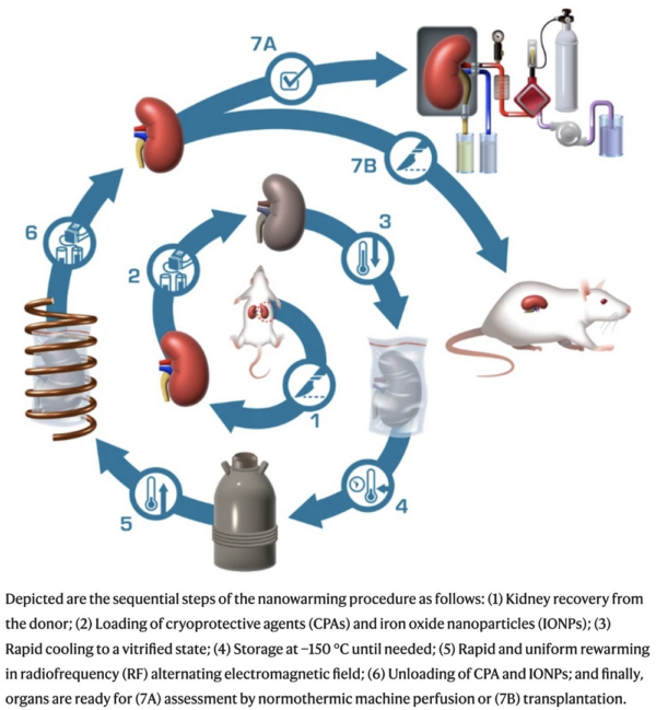 Cryo preserved kidneys thawed and transplanted | Lifespan Research ...