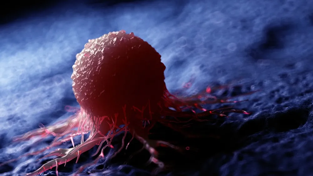 Removing Tumors That Have Senescent Cells | Lifespan.io