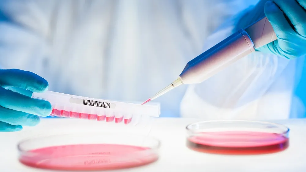 Cellular Programming to Model Aging | Lifespan.io