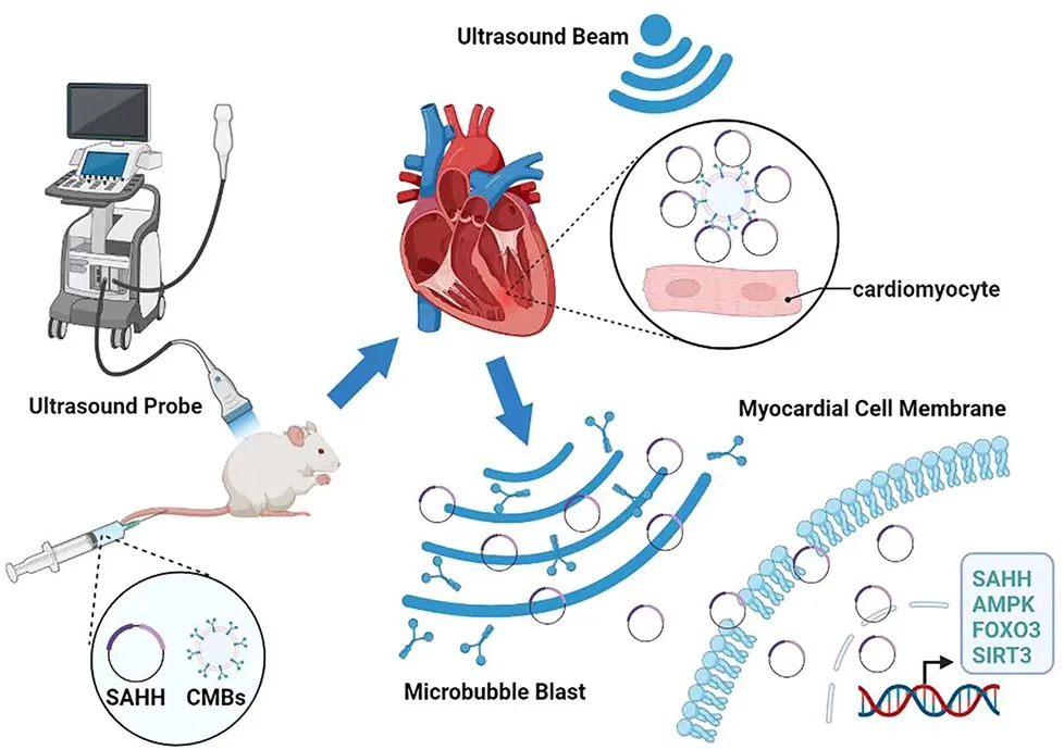 Ultrasound, Gene Therapy, and Diabetes | Lifespan.io