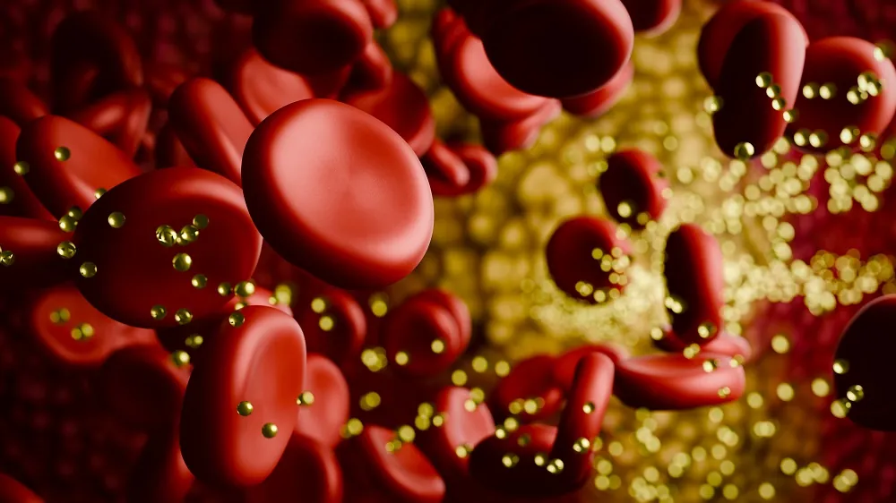 Medium LDL Levels Associated With Lowest Mortality